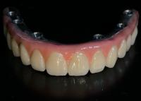 China Custom Fit Dental Implant Support Bar Made from Titanium Alloy Providing Support and Long Term Durability in Implant Dentistry for sale