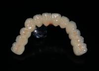 China Authentication Required Zirconia Dental Bridge Engineered For Strength And Longevity In Dental Restoration Applications for sale