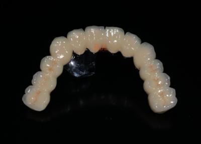 China Authentication Required Zirconia Dental Bridge Engineered For Strength And Longevity In Dental Restoration Applications for sale