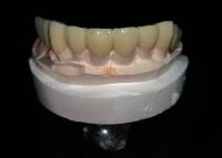 China Authentication Required Zirconia Dental Bridge Engineered For Strength And Longevity In Dental Restoration Applications for sale