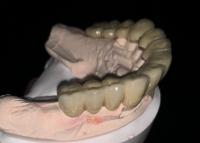 China Authentication Required Zirconia Dental Bridge Engineered For Strength And Longevity In Dental Restoration Applications for sale