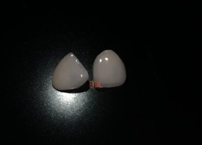 China Highly Transparent Emax Porcelain Veneer Ensuring Seamless Integration and Outstanding Longevity in Dental Applications for sale