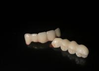 China Durable Ceramic Dental Prosthesis Custom Made Precision Engineered Solutions for Dental Laboratories and Clinics for sale