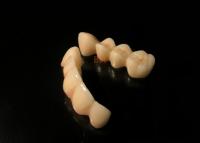 China Durable Ceramic Dental Prosthesis Custom Made Precision Engineered Solutions for Dental Laboratories and Clinics for sale