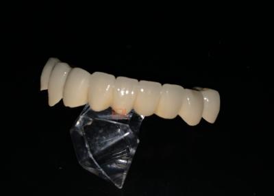 China Long Lasting Porcelain Fused To Metal Crown Durable Material Custom Shade Matching Precision Fit Dental Crown for sale
