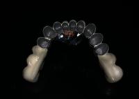 China Custom Porcelain Fused To Metal Crown Designed To Provide Long Term Stability And Natural Look Ideal For Professional Dental for sale