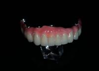 China Durable Dental Implant Support Bar Featuring Superior Mechanical Properties for Effective Dental Prosthesis Integration for sale