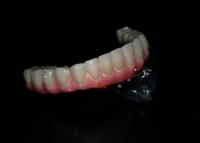 China Durable Dental Implant Support Bar Featuring Superior Mechanical Properties for Effective Dental Prosthesis Integration for sale