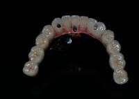 China Durable Dental Implant Support Bar Featuring Superior Mechanical Properties for Effective Dental Prosthesis Integration for sale