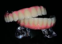 China Titanium Custom Dental Implant Bar Engineered to Provide Superior Support and Stability for Dental Prosthetic Devices for sale