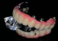 China Titanium Custom Dental Implant Bar Engineered to Provide Superior Support and Stability for Dental Prosthetic Devices for sale