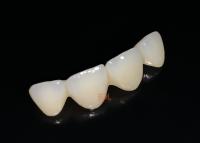 China Innovative zirconia bridge teeth designed to combine strength and natural aesthetics for durable dental bridge solutions for sale