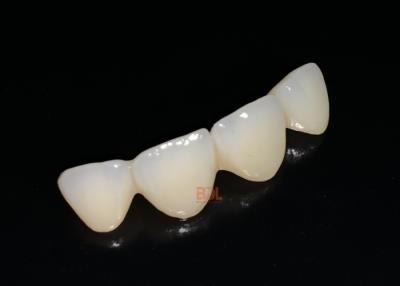 China Innovative zirconia bridge teeth designed to combine strength and natural aesthetics for durable dental bridge solutions for sale