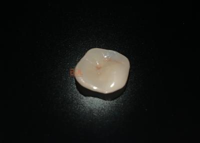 China Innovative Ceramic Dental Prosthetics Featuring Accurate Margins and Enhanced Wear Resistance for Dental Professionals for sale