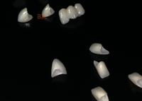 China Lightweight Ceramic Dental Prosthesis Providing Excellent Wear Resistance and Natural Look Perfect for Dental Specialists for sale