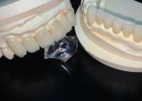 China Lightweight Ceramic Dental Prosthesis Providing Excellent Wear Resistance and Natural Look Perfect for Dental Specialists for sale