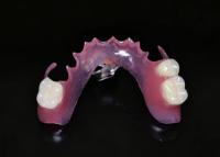 China Durable Flexible Partial Dental Prosthesis Designed To Provide Comfortable Fit And Long Lasting For Dental Professionals for sale