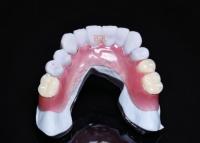 China Durable Flexible Partial Dental Prosthesis Designed To Provide Comfortable Fit And Long Lasting For Dental Professionals for sale