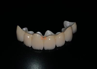 China Durable Ceramic Dental Prosthetics Customized Solutions for Long Lasting Restorations in Dental Clinics and Laboratories for sale