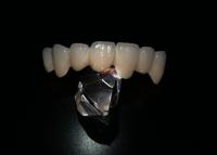 China Durable Ceramic Dental Prosthetics Customized Solutions for Long Lasting Restorations in Dental Clinics and Laboratories for sale