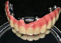 China Custom Fit Titanium Dental Implant Support Bar Engineered for Optimal Stability and Patient Comfort in Dental Procedures for sale