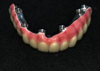 China Custom Fit Titanium Dental Implant Support Bar Engineered for Optimal Stability and Patient Comfort in Dental Procedures for sale