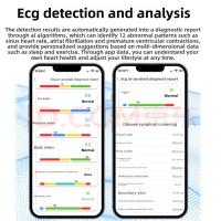China Cross-border New Medical Grade Intelligent ECG Temperature Ring Heart Rate Blood Oxygen AI Analysis Detection Metal IP68 for sale