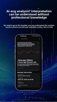 China CardioRing ECG Blood Pressure Smart Ring Medical Grade Dual Core Sleep Blood Oxygen Heart Rate HRV AI Health Tracker for sale