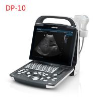 China Portable B Ultrasound Scanner DP-10 Black White Medical Diagnostic Imaging 3.5MHz for sale