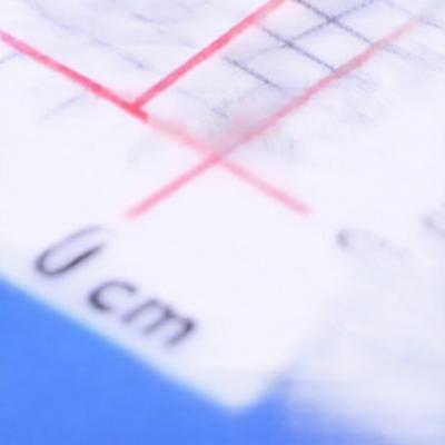 China Multilayer Ceramic Capacitor Darfon Elec C1005NP0339CGT with NP0 Temperature Compensation and Low ESR for sale