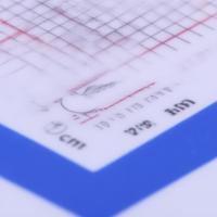 China 3 mm Chip Trimmer Potentiometer Metal Glaze Resistor HDK VG039NCHXTB201 Variable Resistor with 100 to 1 M Ohm Range for sale