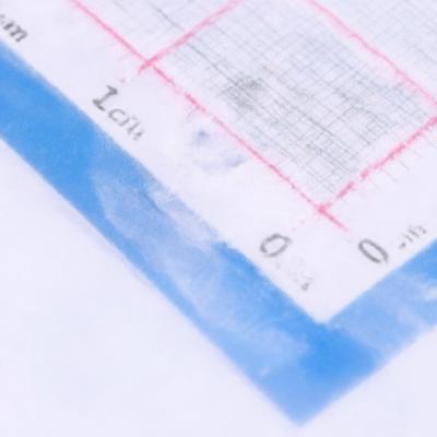 China Automotive Electronics Noise Suppression Murata NFE61HT101Z2A9L Chip EMIFIL LC Combined Type Component for sale