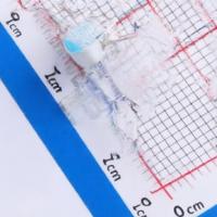 China Surface Mount Conductive Polymer Aluminum Solid Capacitors NCC APXG200ARA391MHA0G with Super Low ESR and High Ripple Current for sale