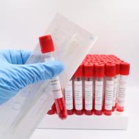 China 1.5ml 2ml Vacutainer Blood Collection Tubes Disposable Virus for sale