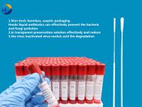China Mycoplasma Ureaplasma Blood Sample Test Tubes 4ml for sale