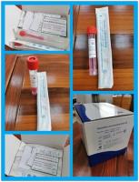 China 10ml Disposable Specimen Collection Tube for sale