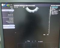 China Wideband Micro Convex Endovaginal Ultrasound Probe Transducer Siemens S2000 EV-8C4 for sale