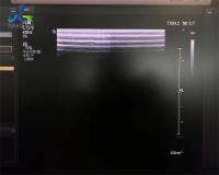 China L12-3 Linear Array Transducer Probe Ultrasound Crystal And Cable Replacement for sale
