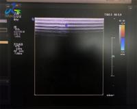 China L12-3 Linear Array Transducer Probe Ultrasound Crystal And Cable Replacement for sale