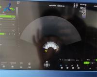 China GE RIC5-9A-RS 3D 4D Endocavity Ultrasound Transducer Dome And Crystal Array Replacement for sale