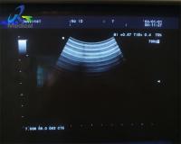 China Aloka ASU-1010 Ultrasound Transducer Probe 4D And Cable Repair for sale
