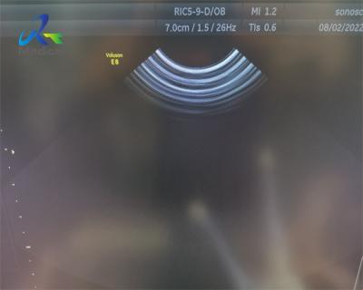 China GE RIC5-9-D 3D 4D Endovaginal Ultrasound Transducer Repair Dome Replacement for sale