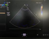 China S5-1 Linear Array Ultrasound Transducer Probe Crystal Array Replacement for sale