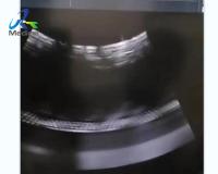 China GE Voluson E10 Ultrasound Machine Repair Image Anomaly Replace Rfm Board for sale
