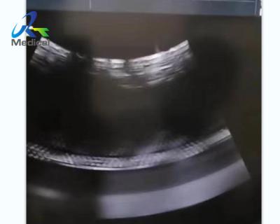China GE Voluson E10 Ultrasound Machine Repair Image Anomaly Replace Rfm Board for sale