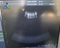 China GE RAB2-6-RS Ultrasound Transducer Crystal Array Replacement 4D And Cable Repair for sale