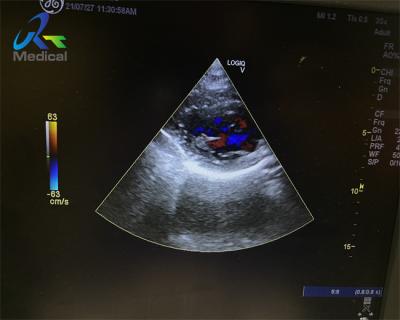 China GE 3SC-RS Ultrasound Probe Repair Original Crystal Array Replacement for sale