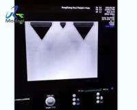 China GE Voluson E10 Image Anomaly Ultrasound Machine Repair RFM423 for sale