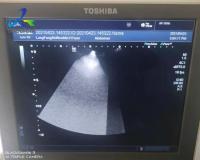 China Toshiba Aplio 300 Echo Zone Has Shadows Ultrasound Repair Service Replace Control Panel for sale