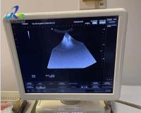 China Hitachi Aloka Ascendus Image Missing Ultrasound Machine Repair Replace TRX Board for sale